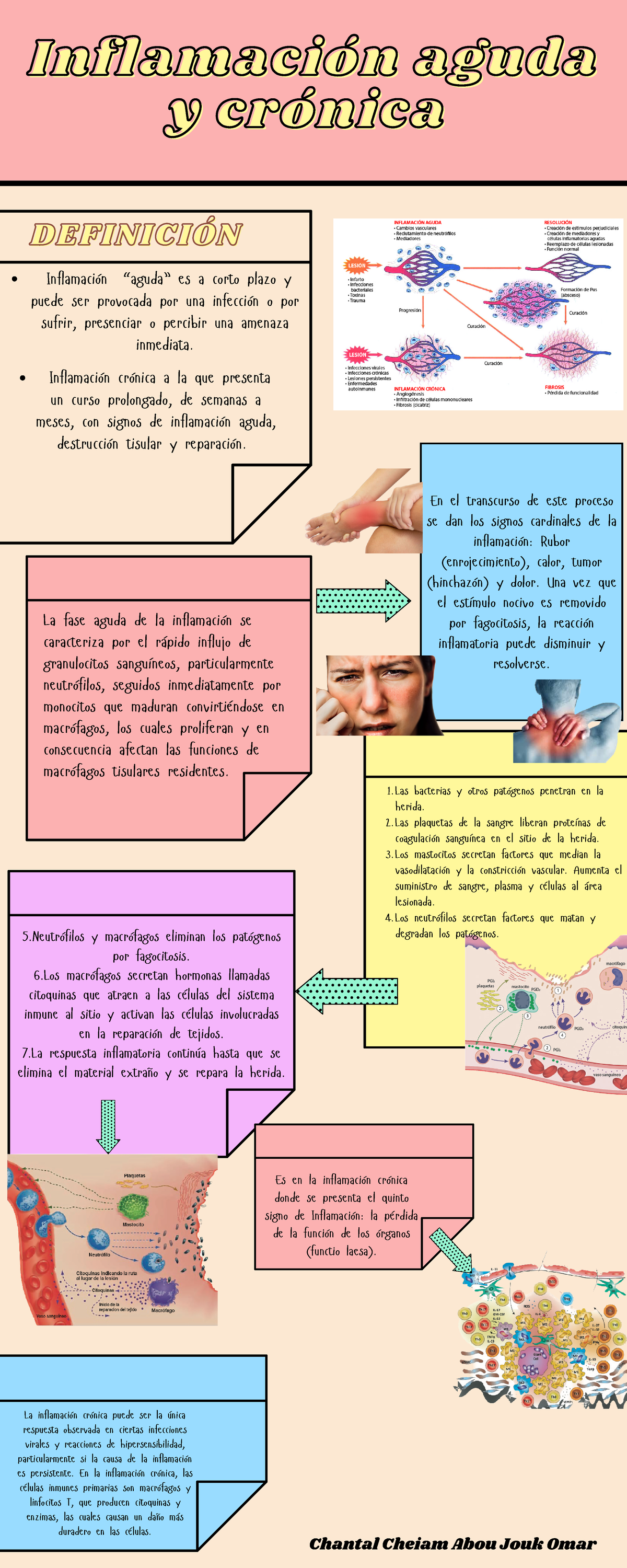 Infografía inflamación aguda y crónica - En el transcurso de este ...