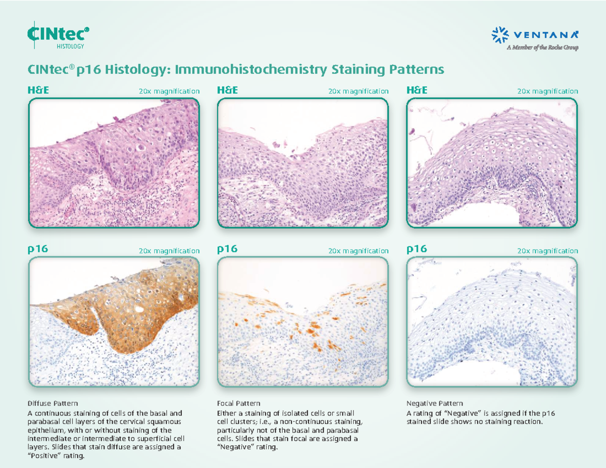 N4693C Final Exam: p16 Histology Staining Patterns Analysis - Studocu