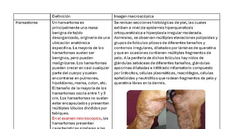 Hamartoma y Coristoma: Definición y Características Histológicas - Studocu