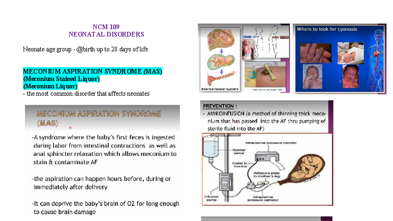 NCM 109 Final Exam Notes on Neonatal Disorders and Sepsis - Studocu