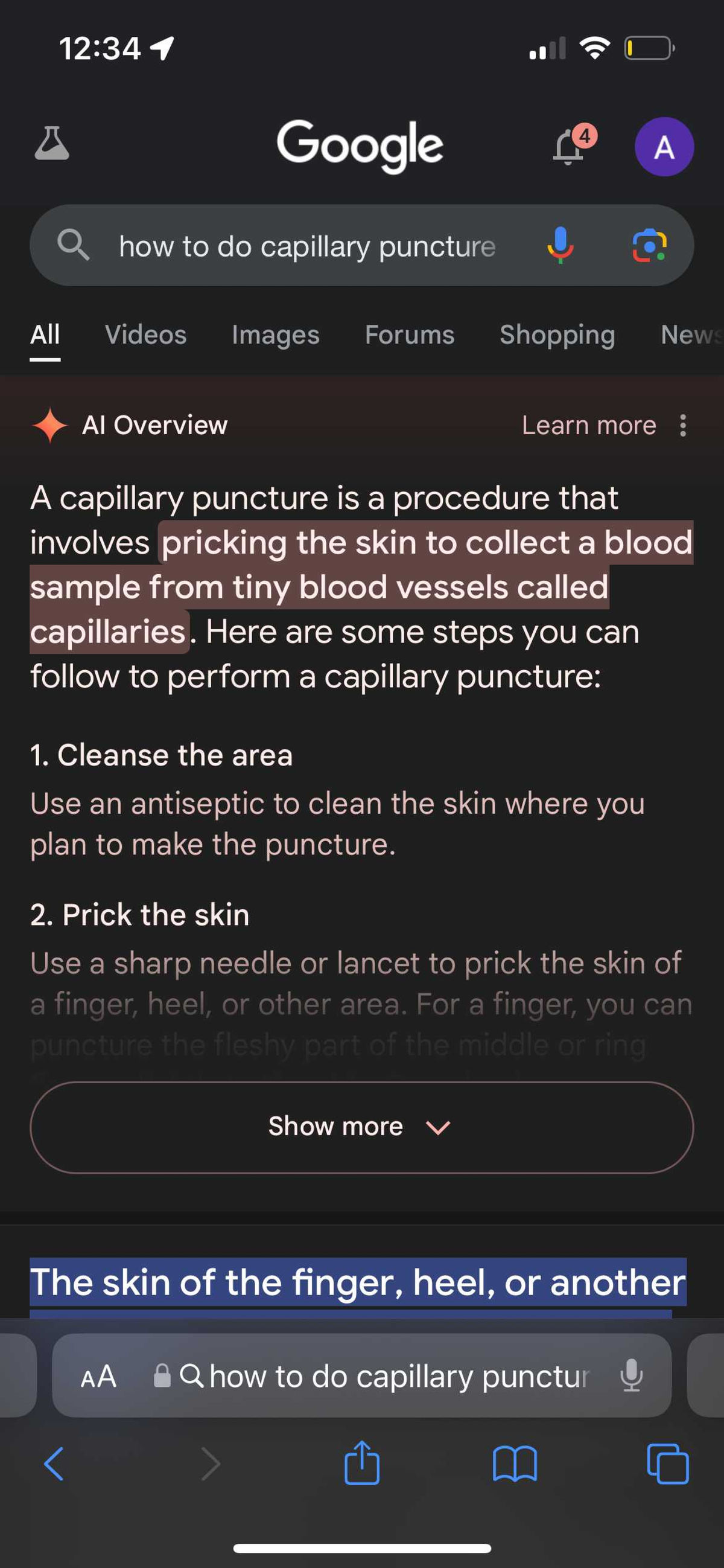 IMG 5553 - How to give capillary puncture - 12:34 4 Google 4 A how to ...