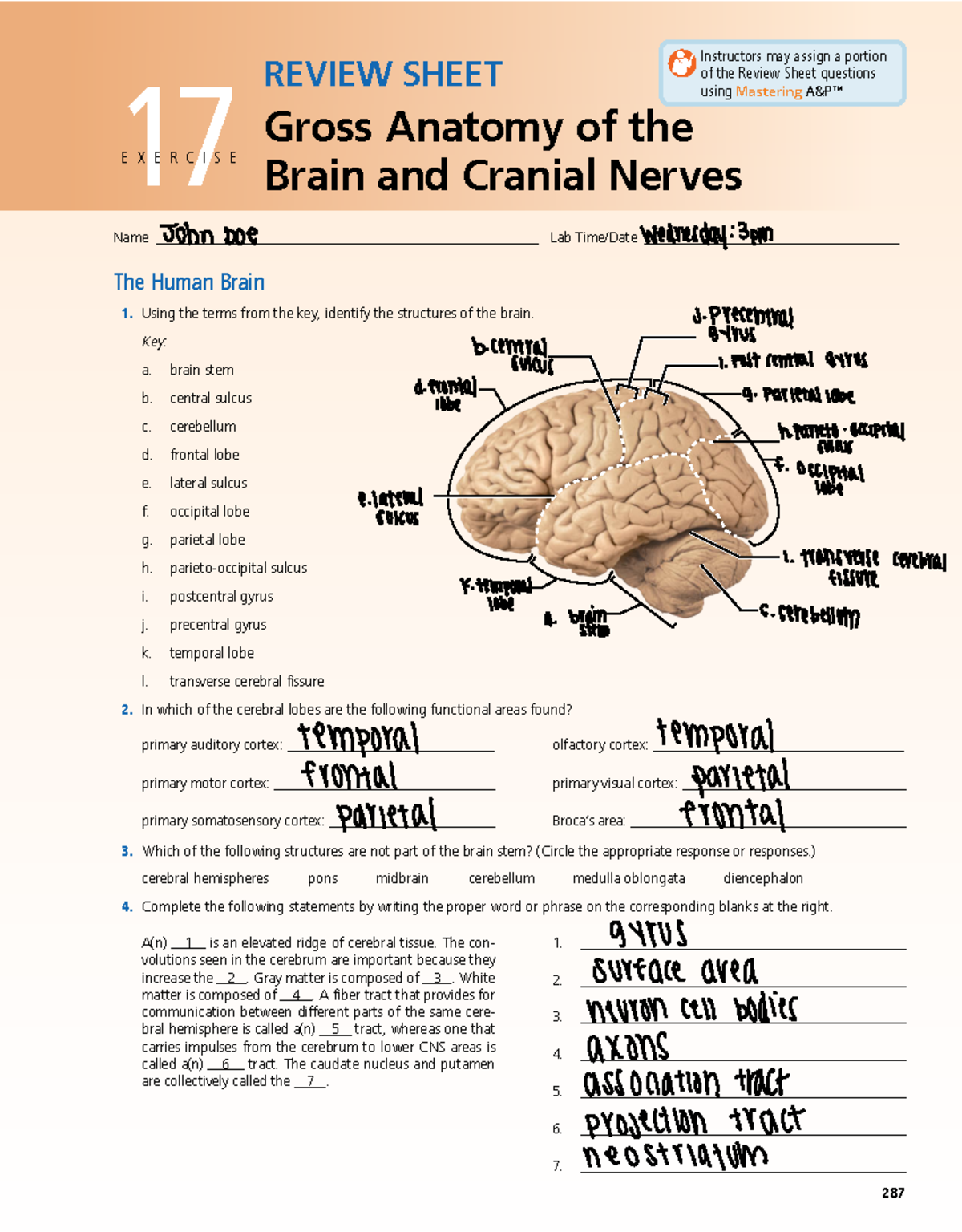 Exercise 19 Gross Anatomy Of The Brain