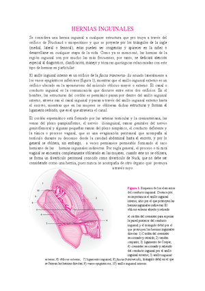 CIE 10 K81.0 Colecistitis Aguda: Definición, Etiología y Tratamiento ...