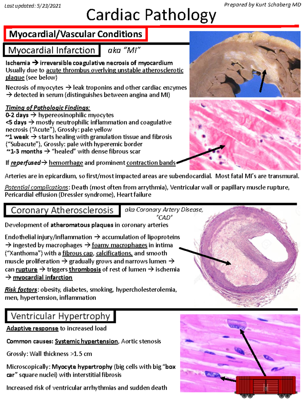 Cardiac Pathology Overview: Myocardial Infarction & Related Conditions ...