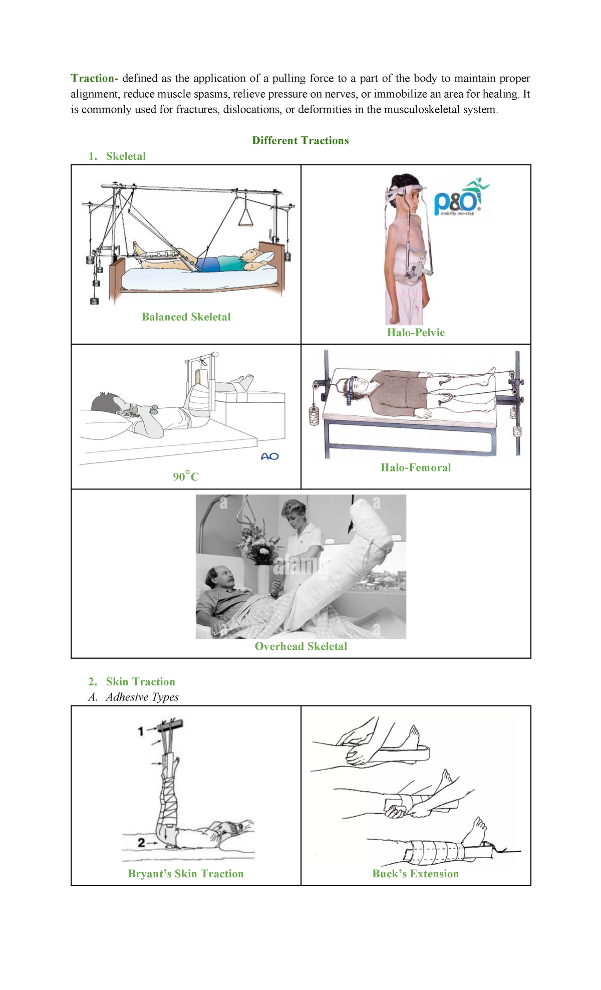 Types of Traction - BS Nursing - Traction- defined as the application ...