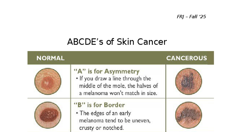 N344 - Abcdes of Skin Cancer - NUR 3321 - FRJ – Fall ‘ ABCDE’s of Skin ...