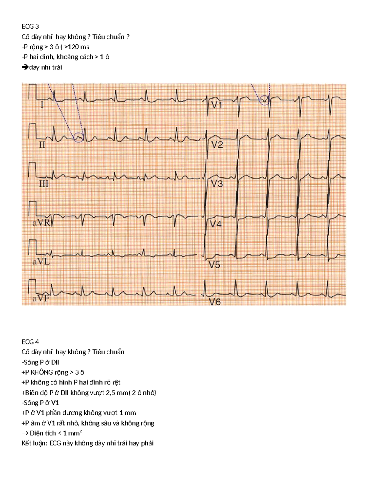 Nhan ECG 3,4 - ecg - Nội tim mạch - ECG 3 Có dày nhĩ hay không? Tiêu ...