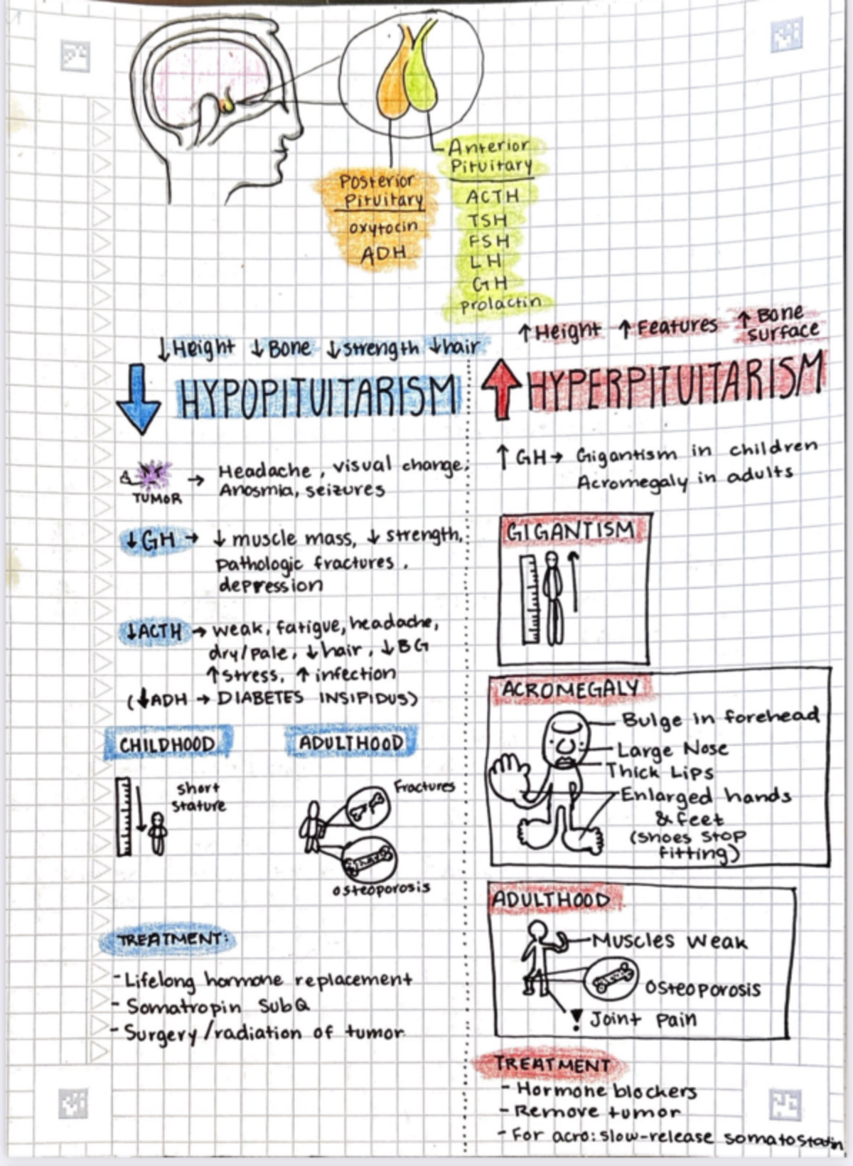 Endocrine disorders - hypopituitarism, hyperpituitarism Diabetes ...