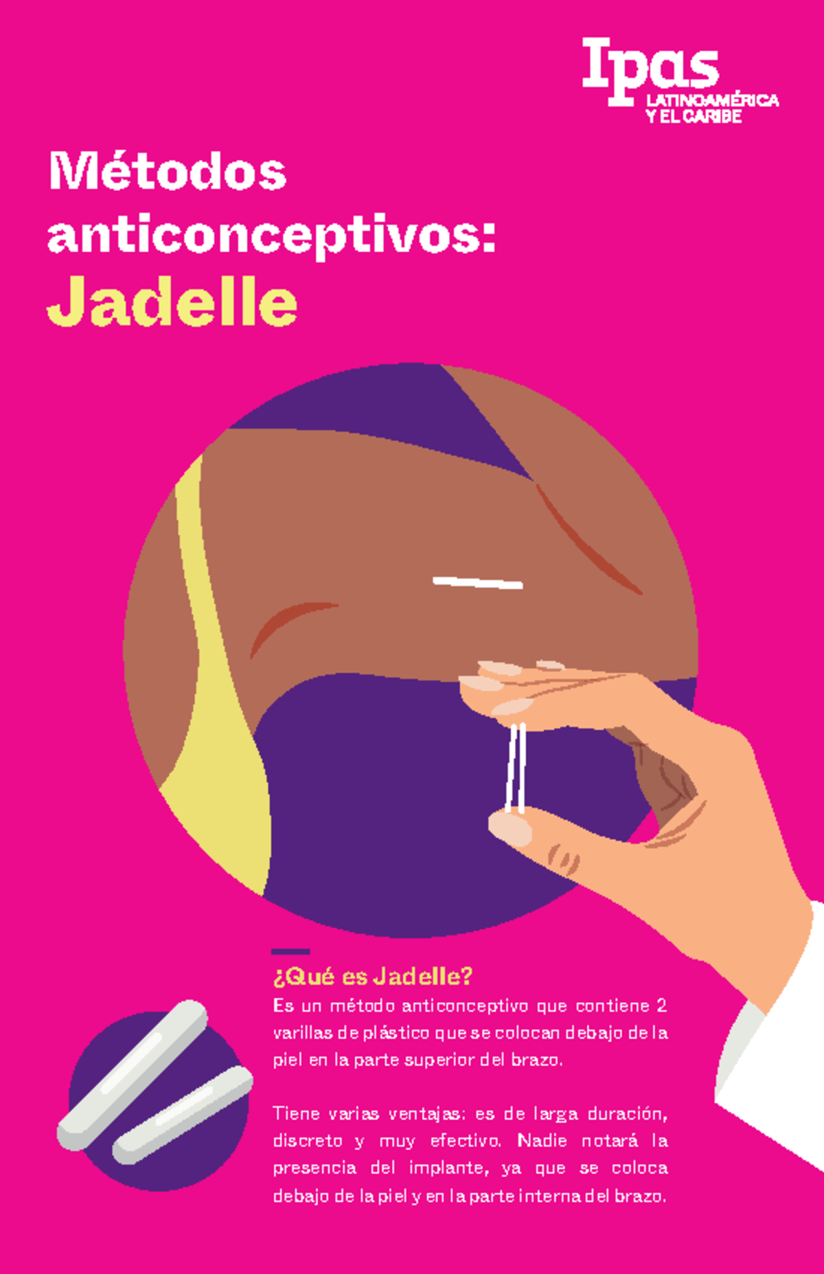 Metodos-anticonceptivos - Métodos anticonceptivos: Jadelle ¿Qué es ...