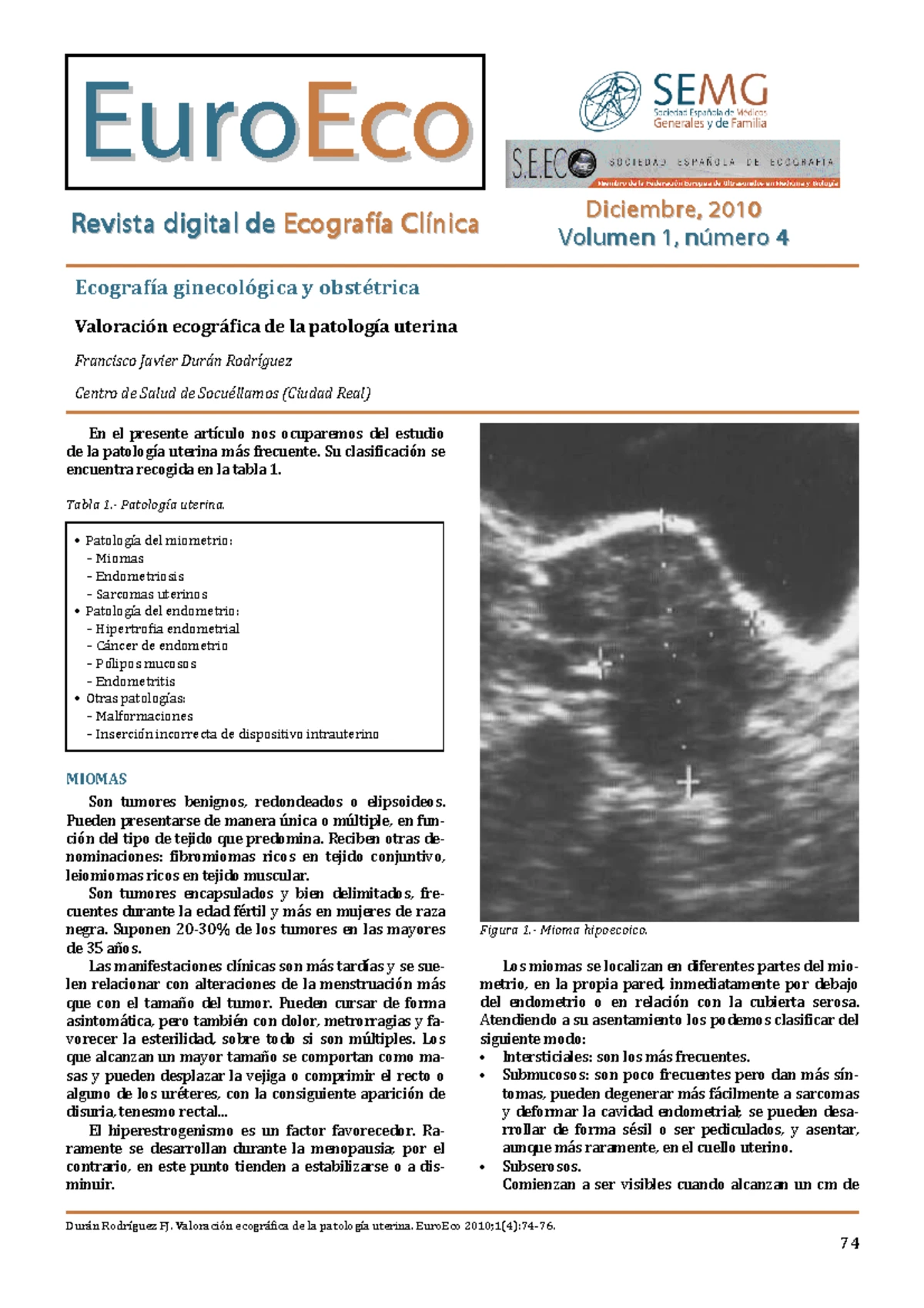 Manejo Del DIU Traslocado - 7 Manejo de dispositivo intrauterino ...