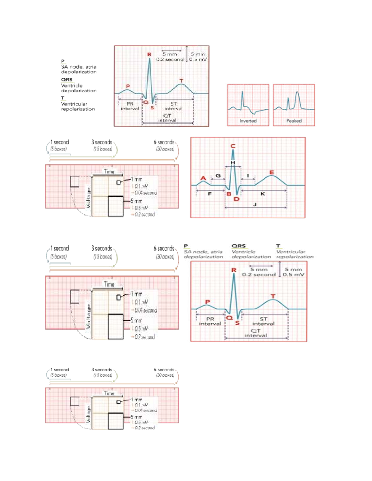 Rhythm Analysis: SA Node, Atria, and Ventricular Depolarization - Studocu