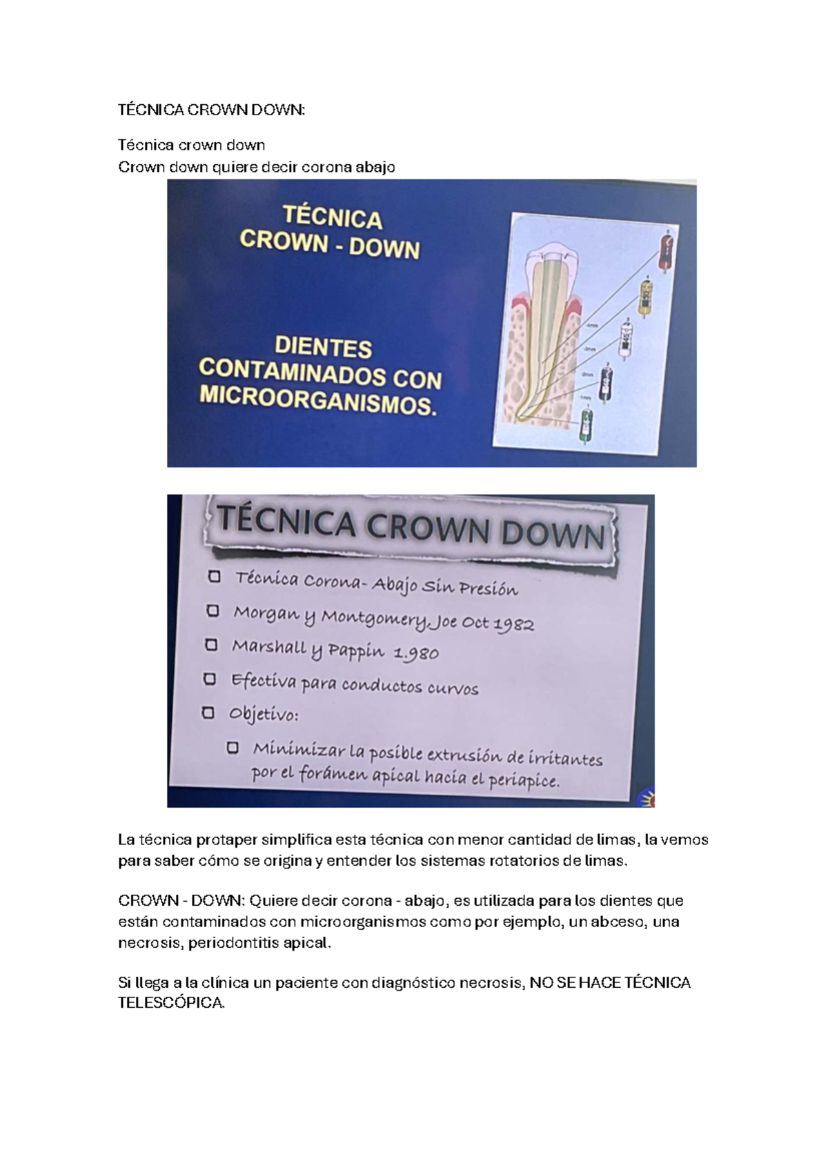 Técnica Crown Down: Resumen y Aplicaciones en Endodoncia - Studocu