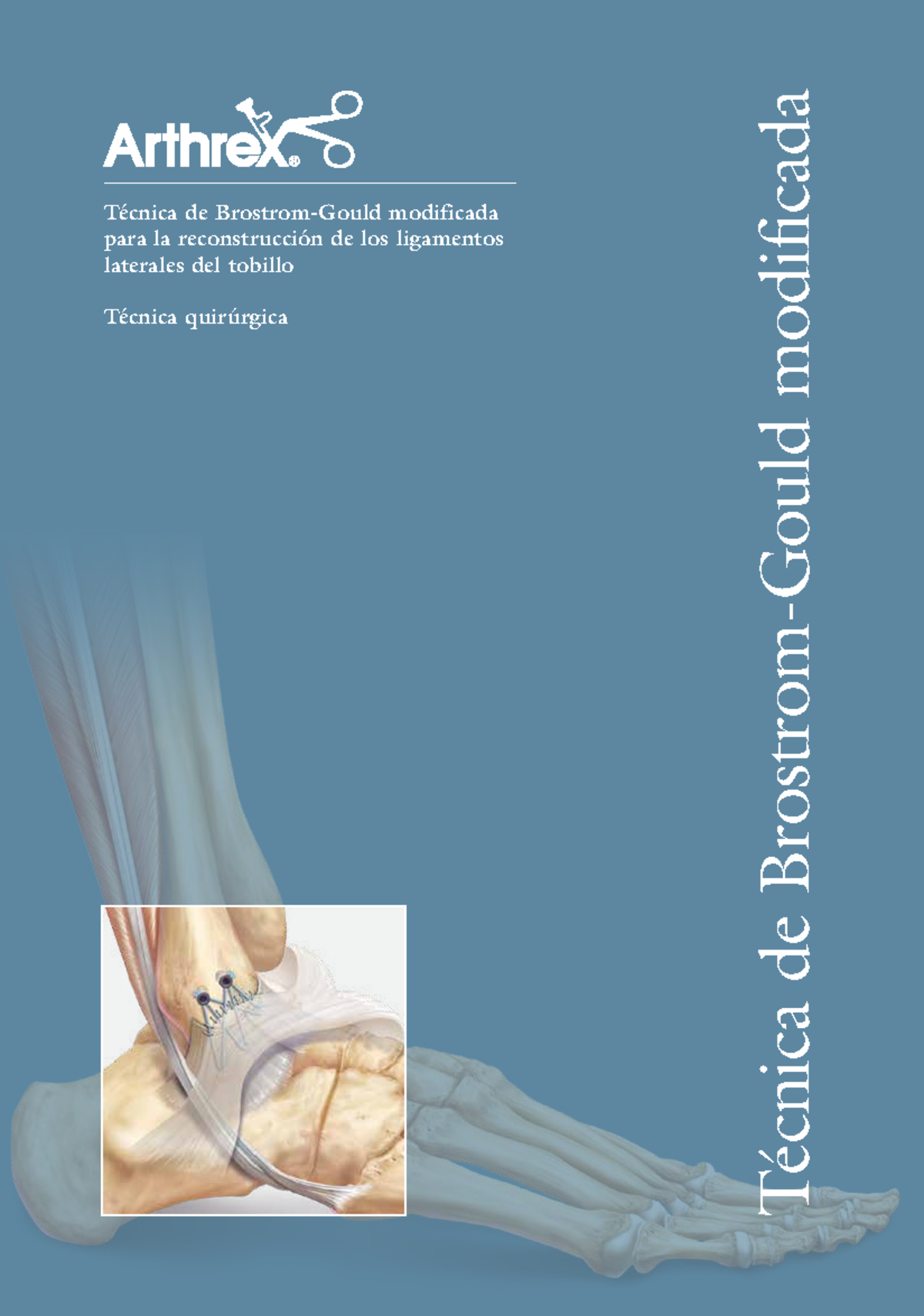 Técnica Quirúrgica Brostrom-Gould para Reconstrucción de Tobillo - Studocu