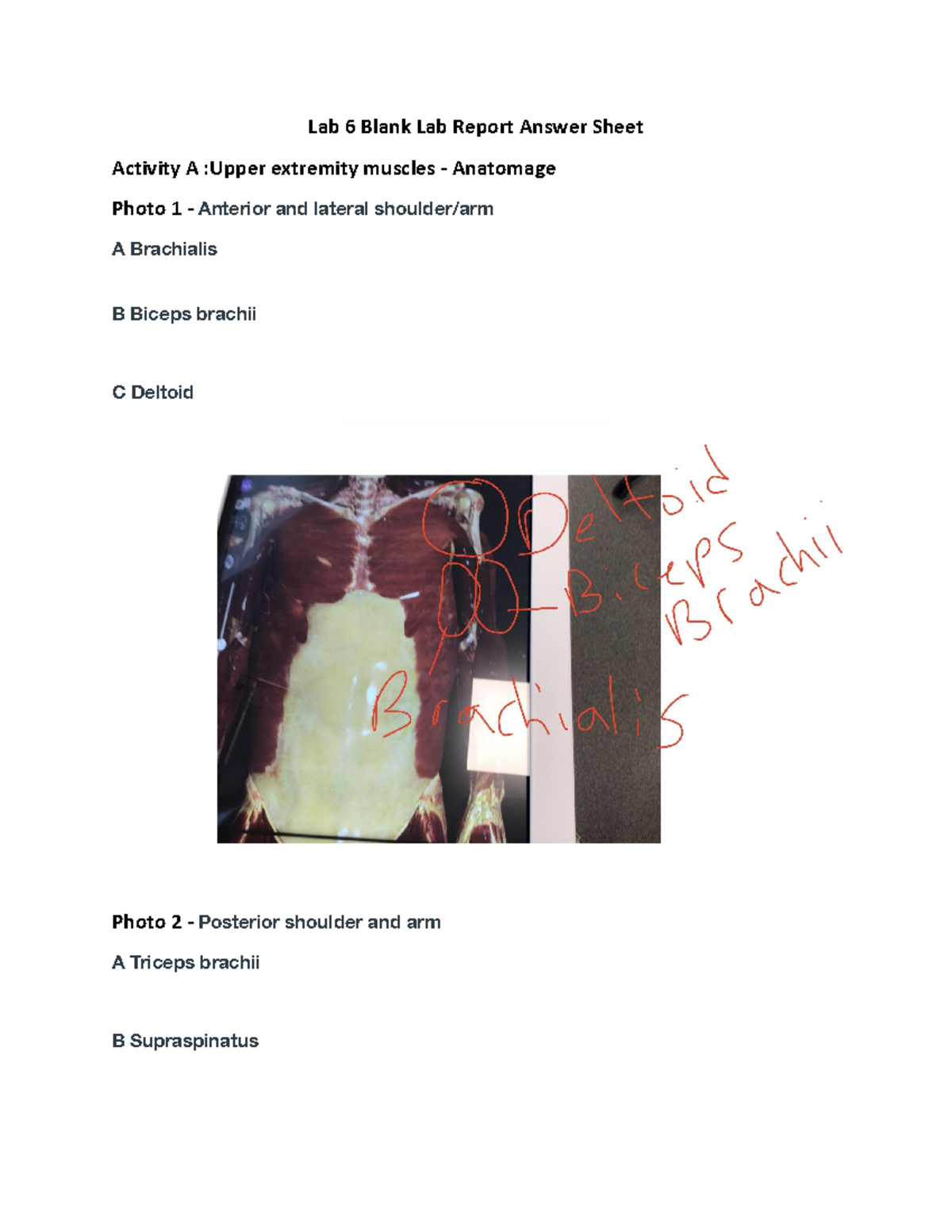 Lab 6: Upper Extremity Muscle Activity & Anatomy Report - Studocu
