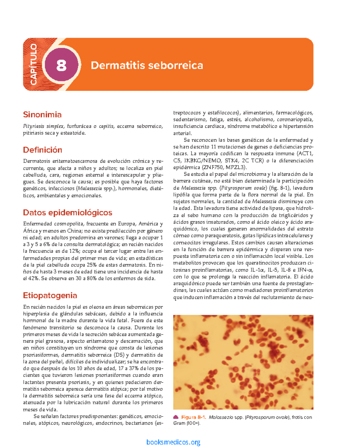 Dermatitis seborreica - Sinonimia Pityriasis simplex, furfurácea o ...