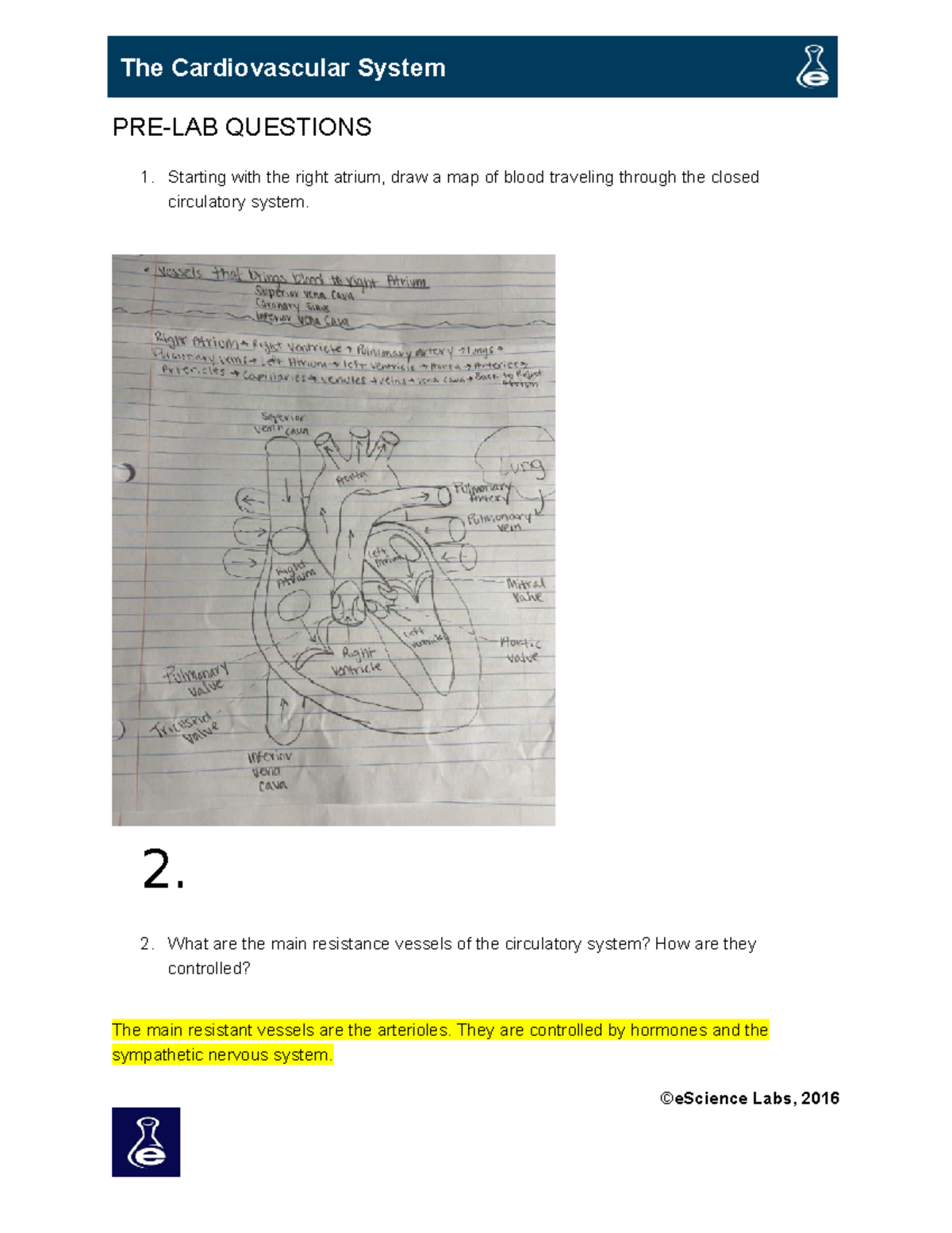 AP 5021 L02 Cardiovascular - PRE-LAB QUESTIONS 1. Starting with the ...