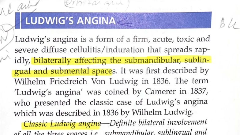Ludwig's Angina - Medical Notes on Diagnosis and Treatment - Studocu