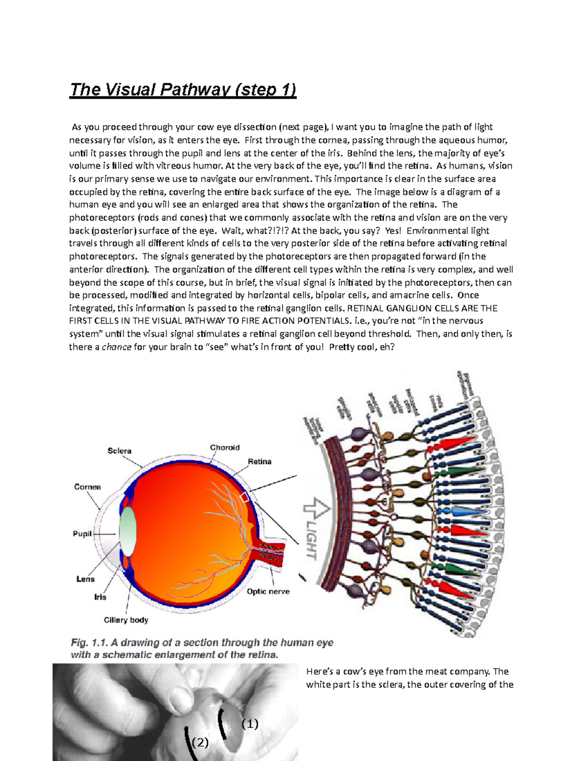The Visual Pathway - Cow Eye Dissection - (1) (2) The Visual Pathway ...