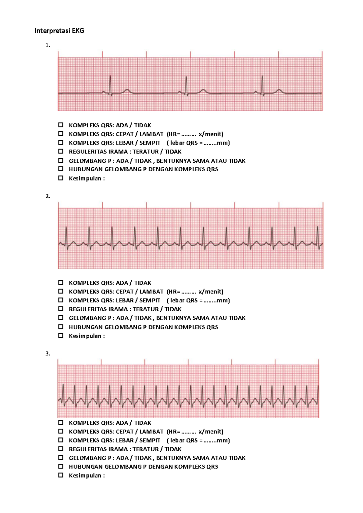 Tugas Interpretasi EKG: Analisis Kompleks QRS dan Irama - Studocu