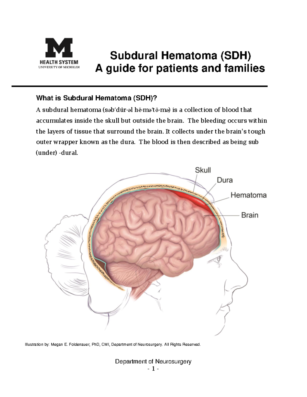 SDH - notes - Department of Neurosurgery Subdural Hematoma (SDH) A ...