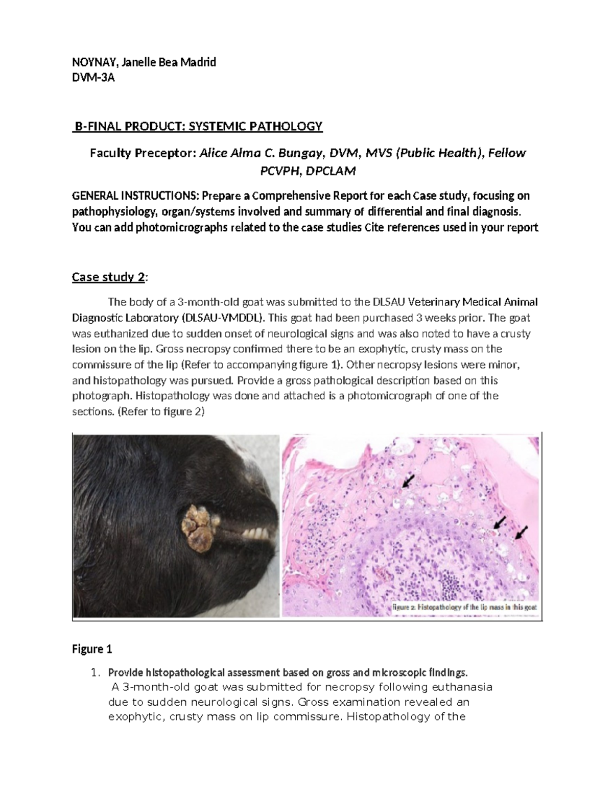 2025 B Final Case Study Report: Systemic Pathology (DLSAU) - Studocu