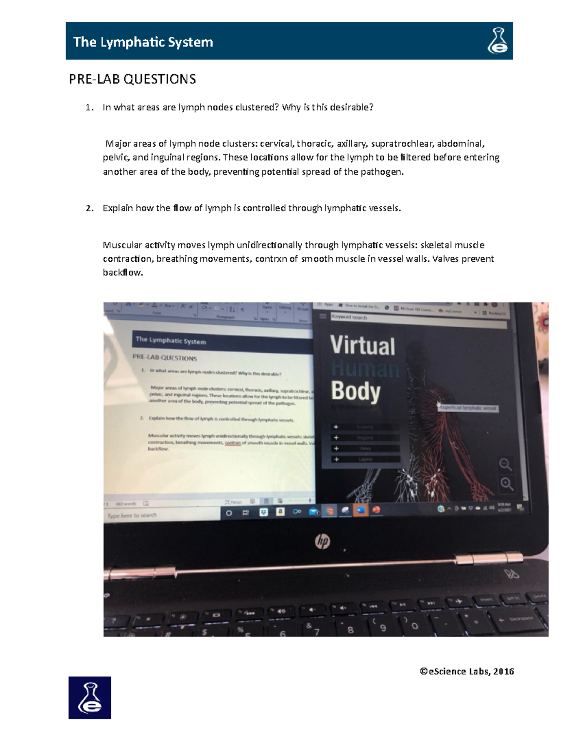 AP 5069 L12 Lymphatic - Virtual Lab Post-Lab Qs & Answers with Images ...