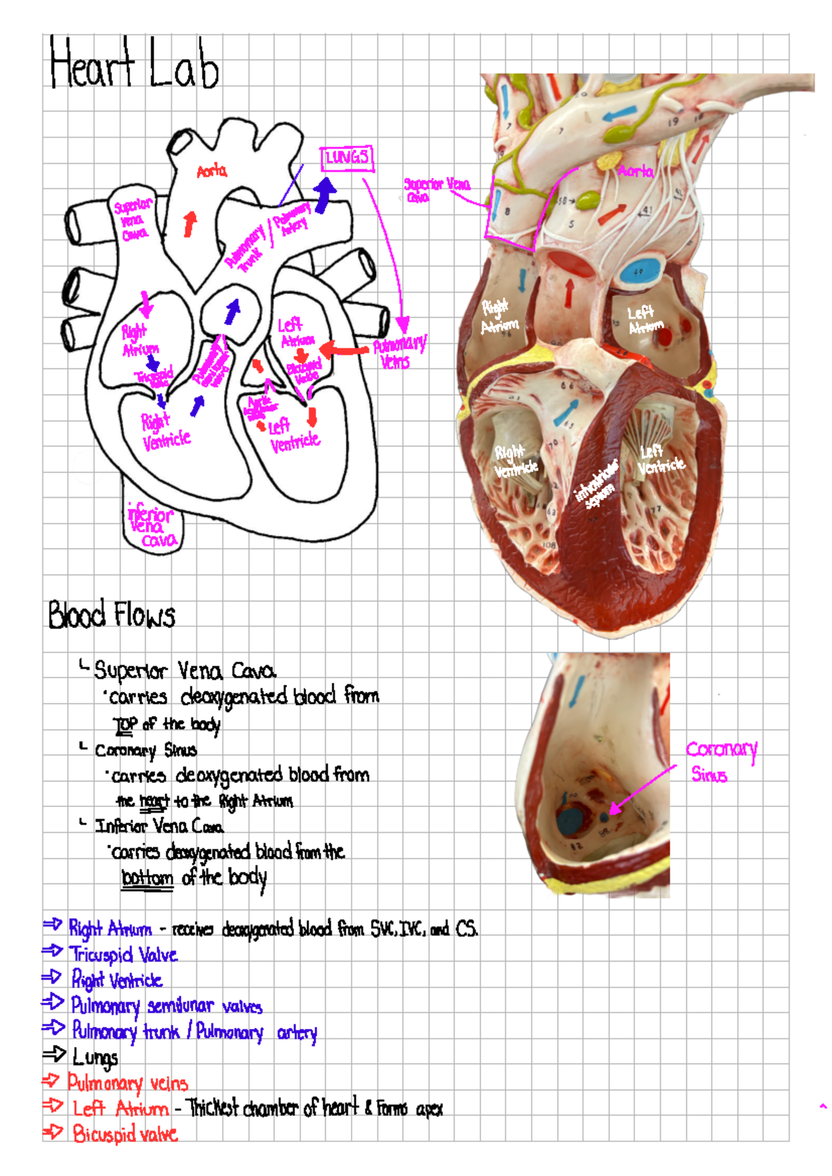 Heartlab Review - lab - Heart Lab LUNGS Aorta Superior Vena Cava ...