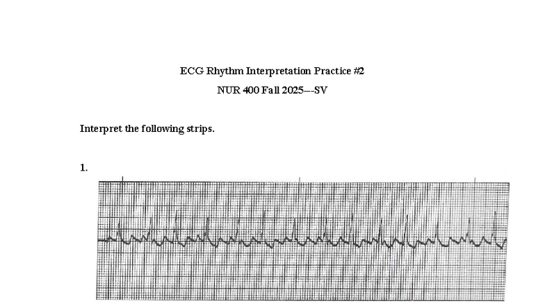 ECG Rhythm Interpretation Practice #2 NUR 400 Fall - Studocu