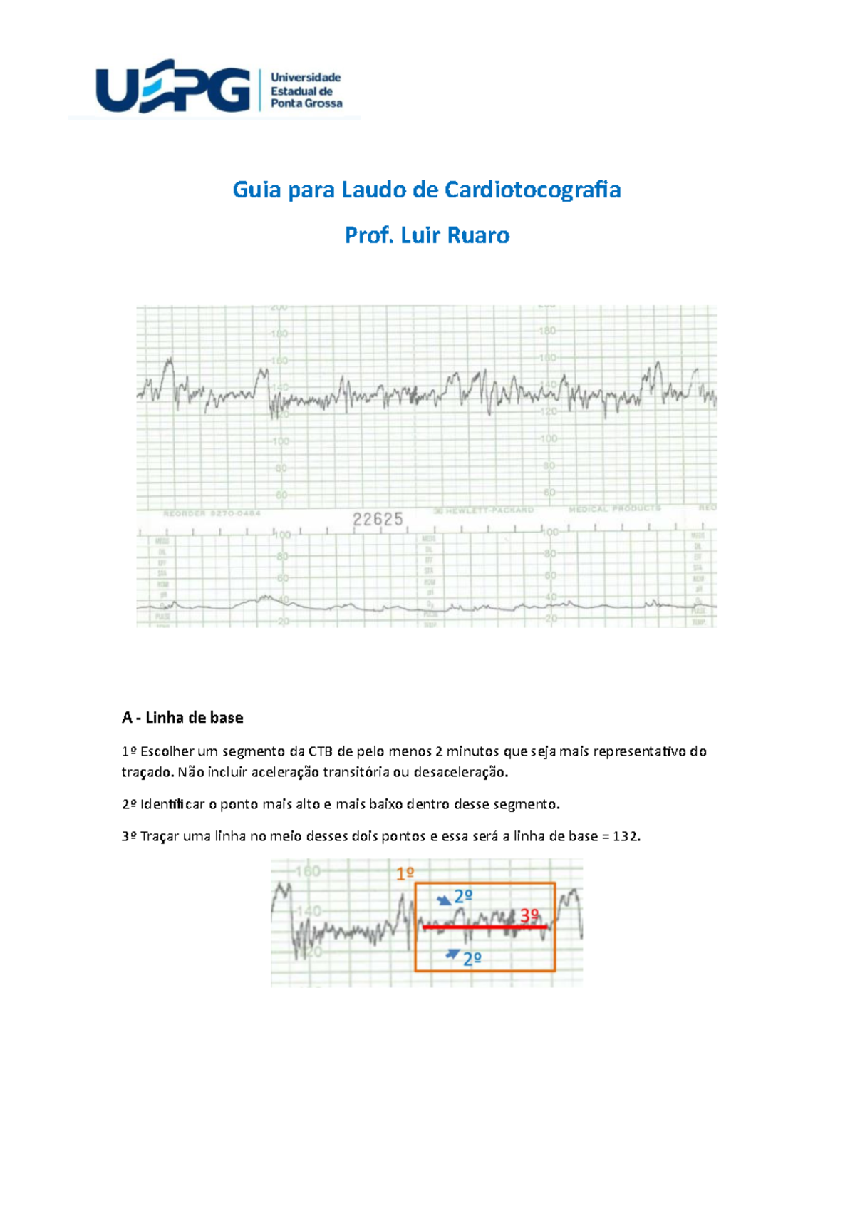 Guia Completo para Laudo de Cardiotocografia - Prof. Luir Ruaro - Studocu