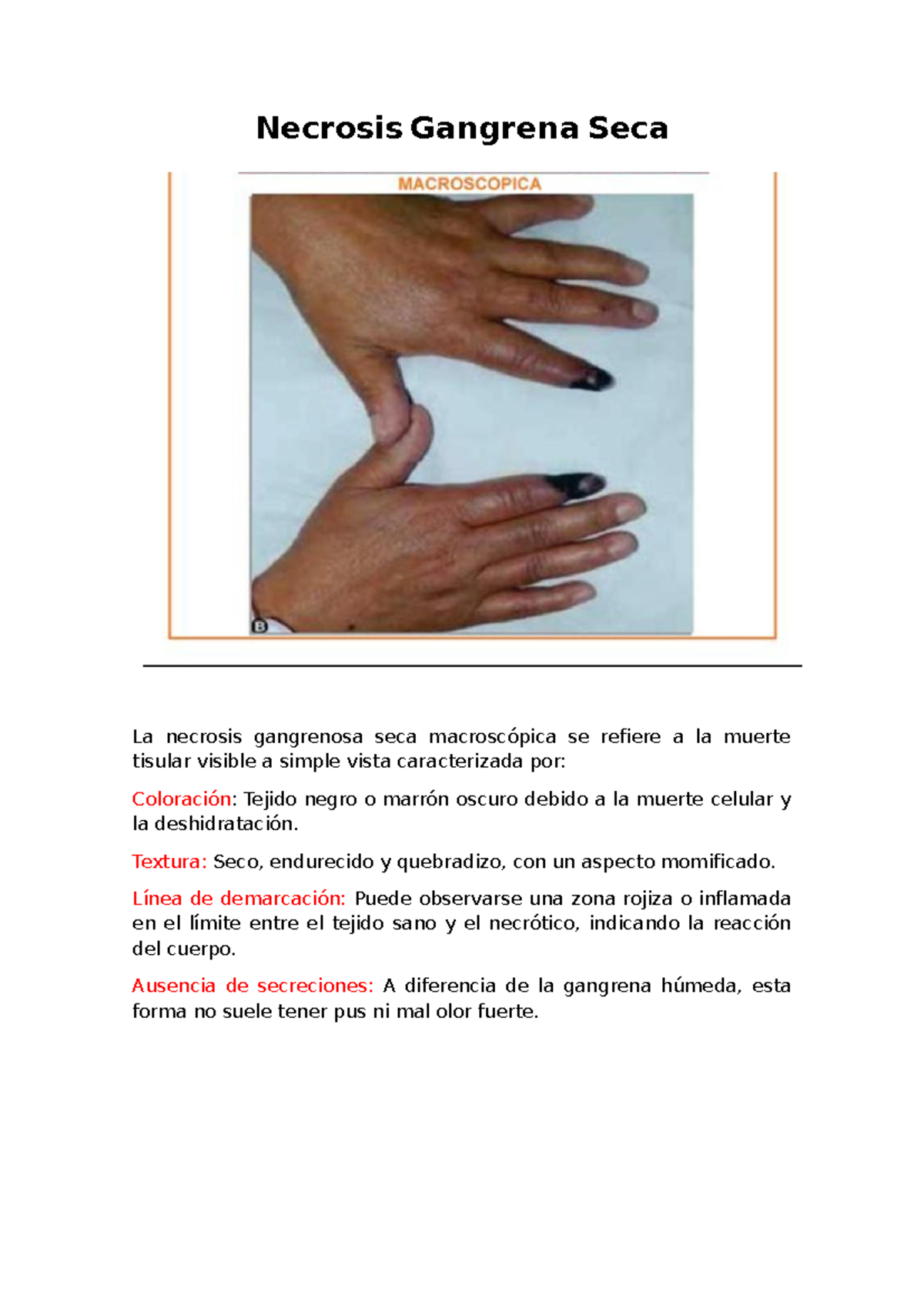 Documento - Apuntes - Necrosis Gangrena Seca La necrosis gangrenosa ...