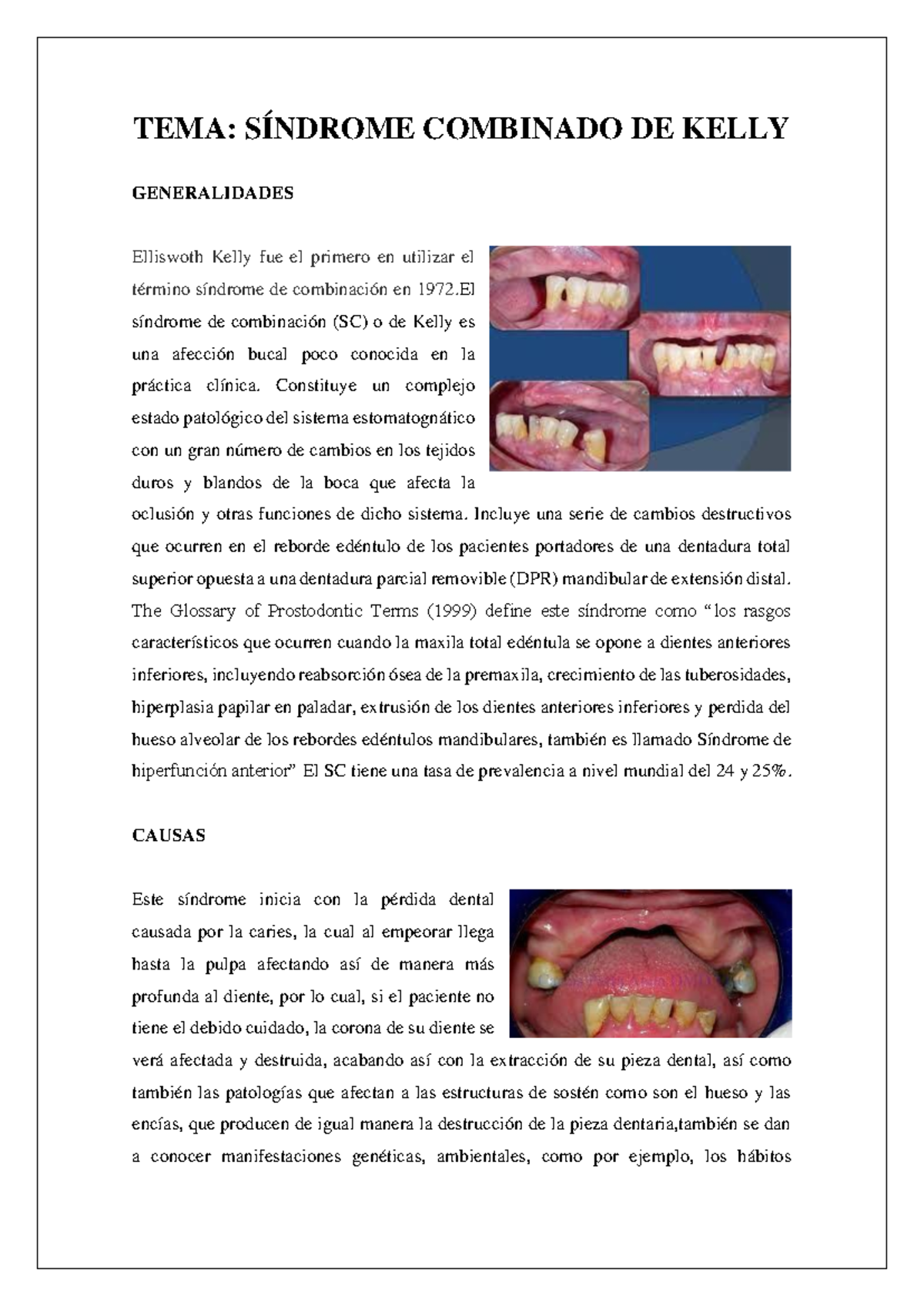 Sindrome Combinado de Kelly: Diagnóstico y Características Clínicas ...