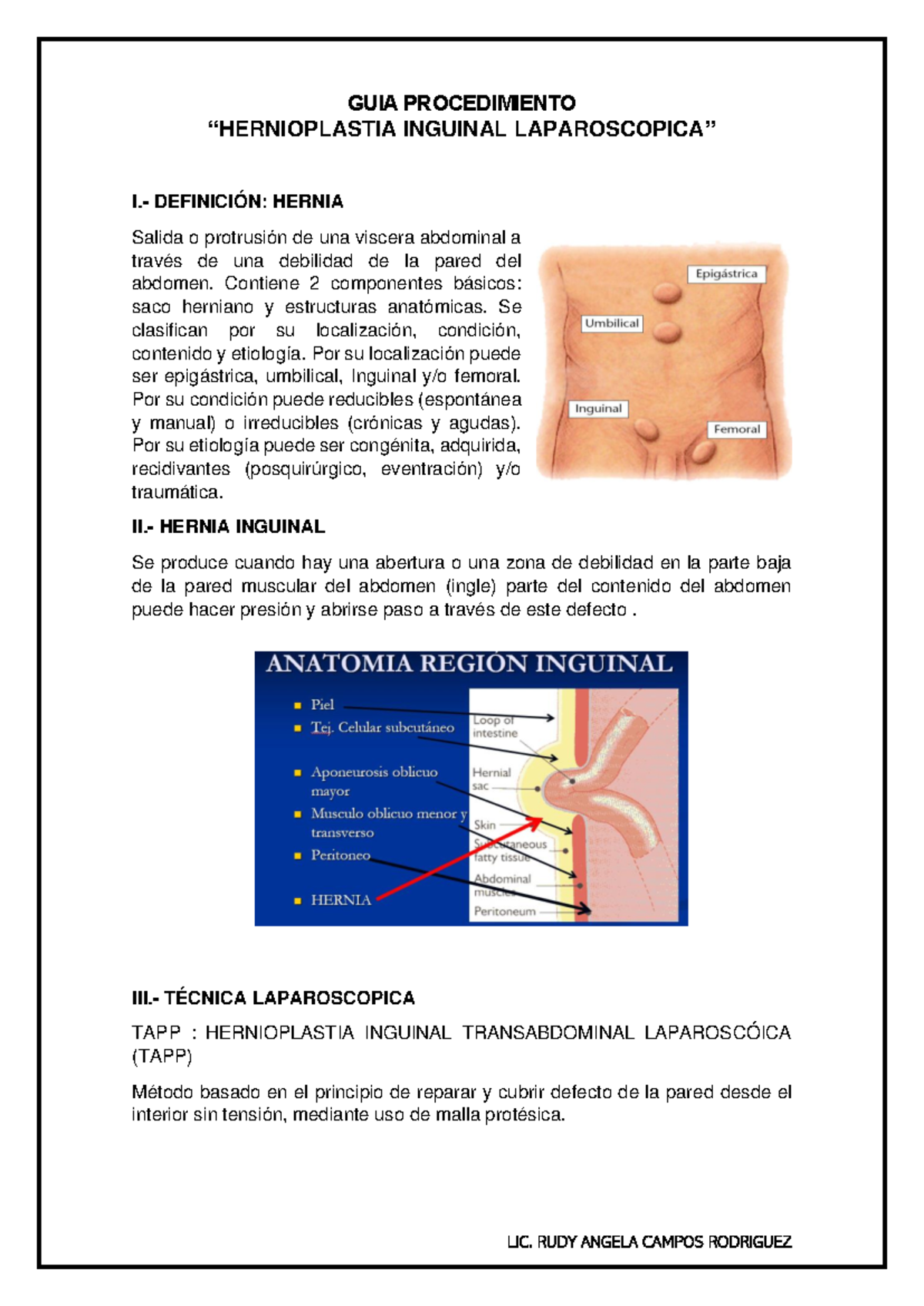 GUÍA TAPP: Procedimiento de Hernioplastia Inguinal Laparoscópica - Studocu