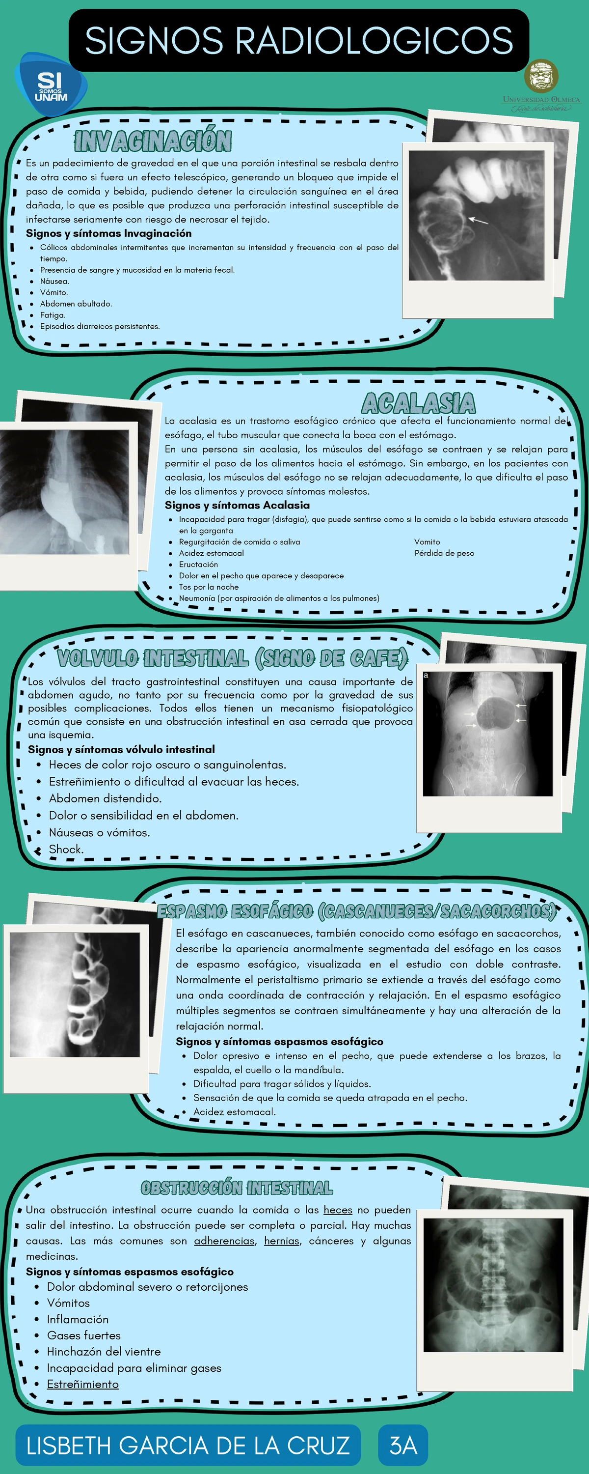 Signos Radiológicos de Intususcepción y Vólvulo Intestinal - Studocu