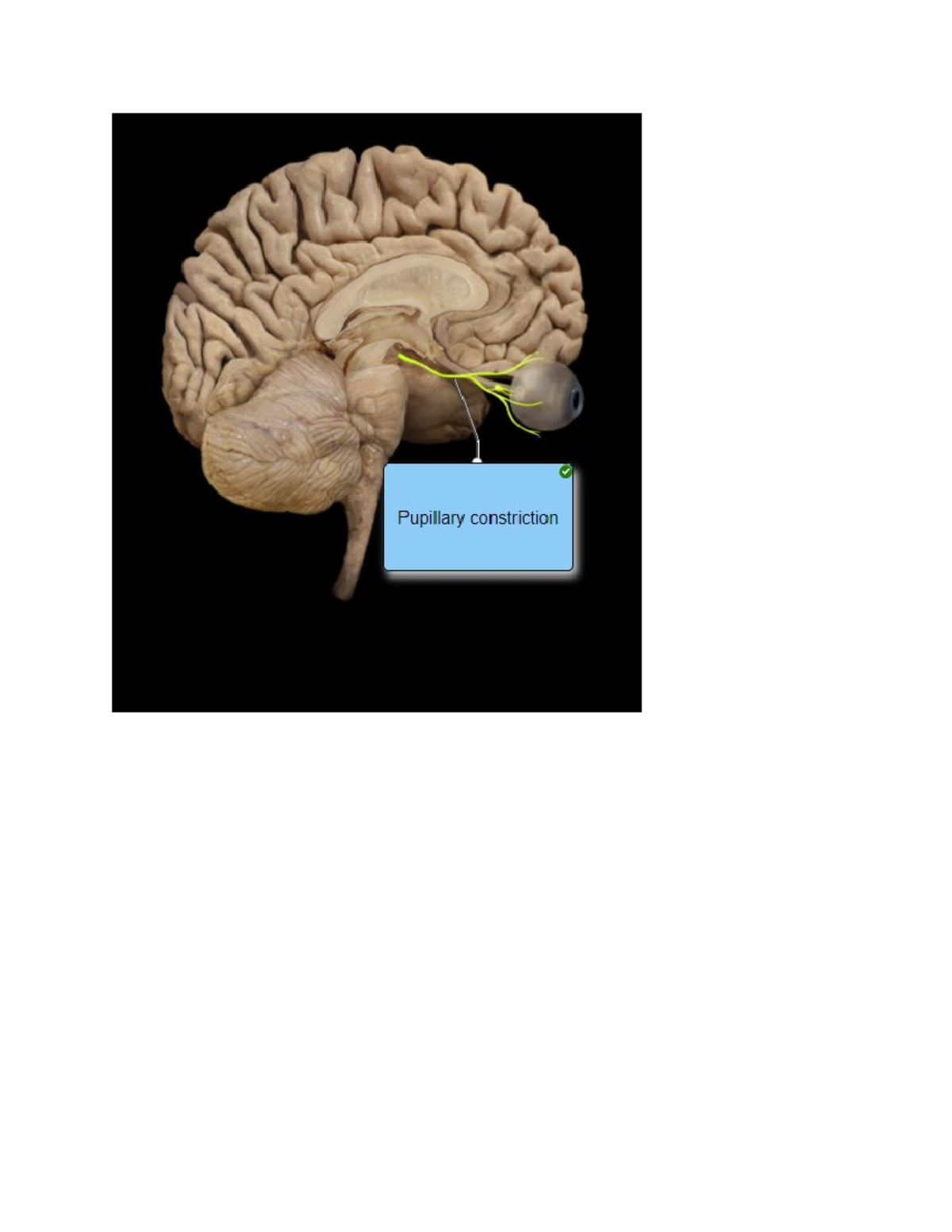 Nervous System (Senses) LAB Visuals & Key Concepts Explained - Studocu