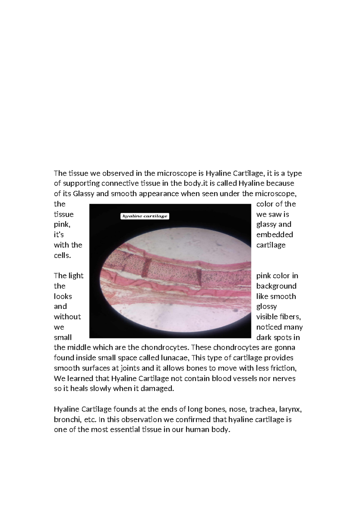 Hyaline Cartilage: Microscopic Observations and Functions - Studocu