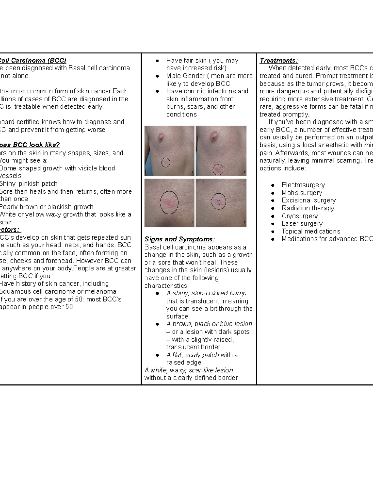 Basal Cell Carcinoma (BCC)- Savanna Neikirk - growth with visible blood ...