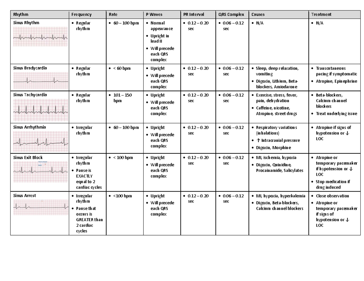 Cardiac Rhythms EKG Analysis: Causes, Treatments & Rates - Studocu