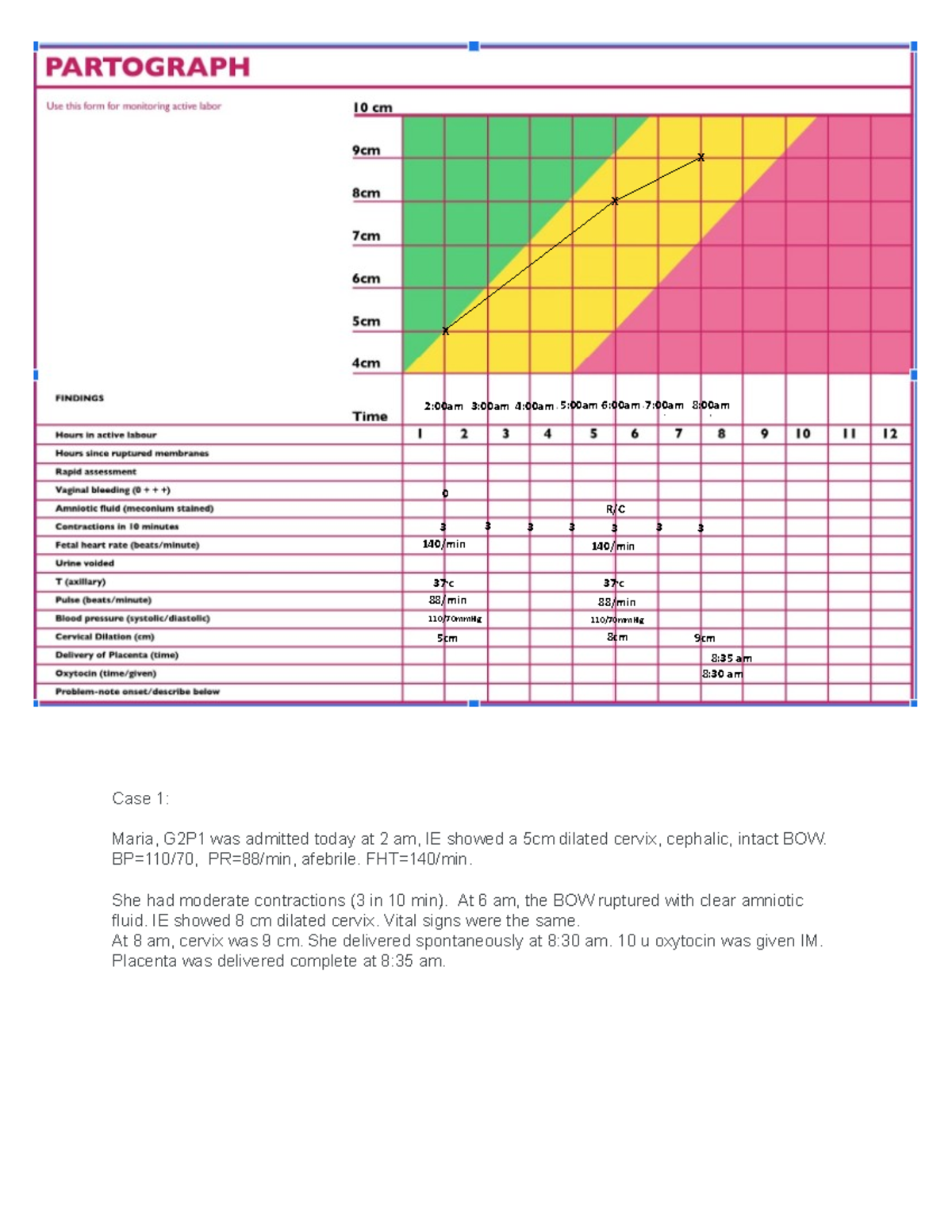 Community Nursing - Partograph - Case 1: Maria, G2P1 was admitted today ...