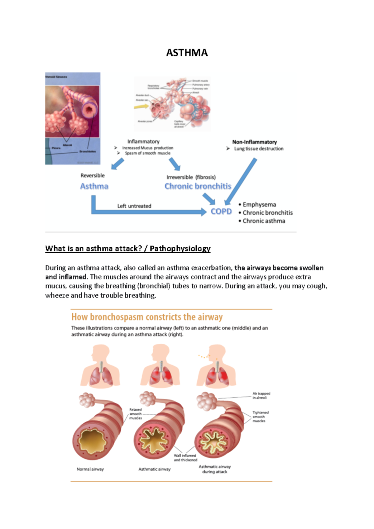 Meds and Respiratory - ASTHMA What is an asthma attack ...
