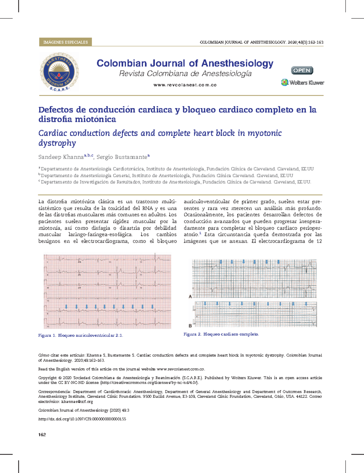 Cardiac Conduction Defects & Complete Heart Block in MD: J Anesth 2020 ...