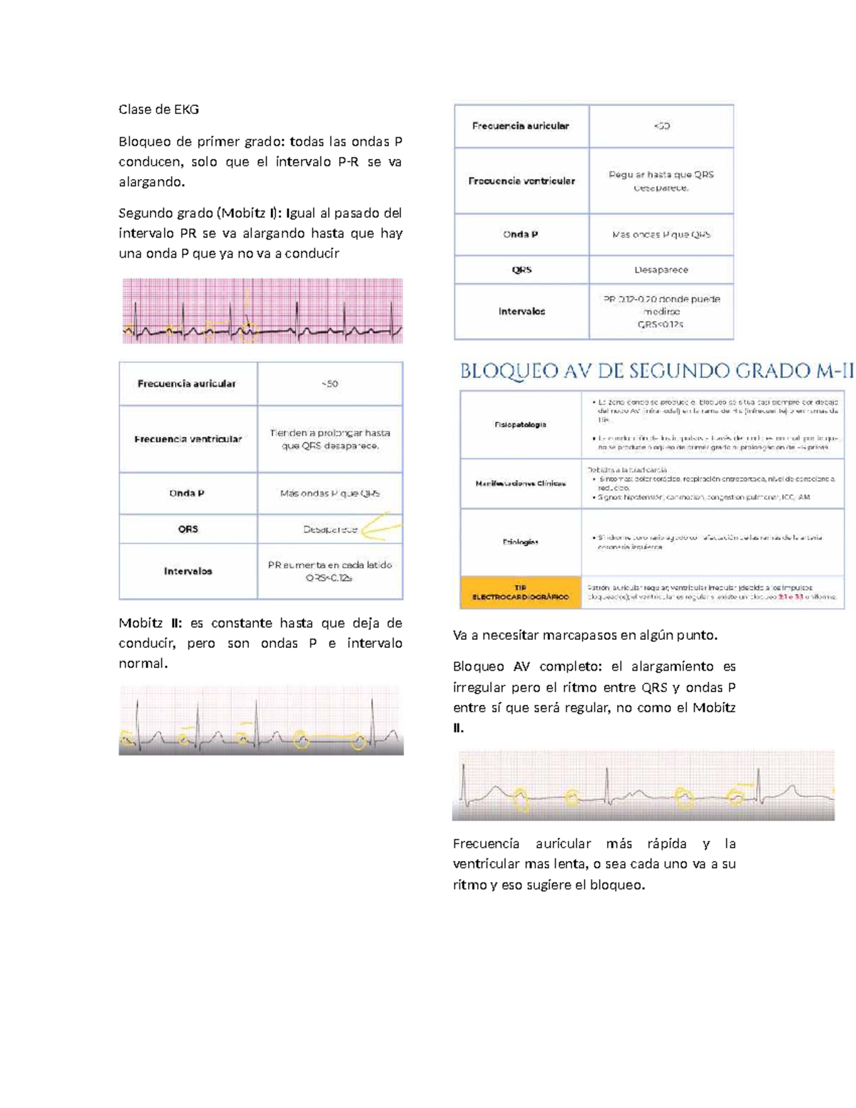 Clase de EKG: Repaso de Bloqueos y Taquicardias - Studocu