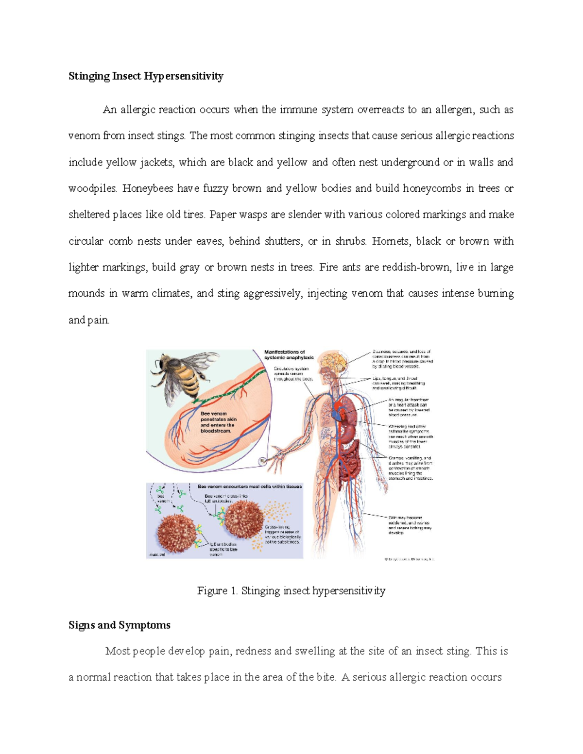 Stinging Insect Hypersensitivity: Understanding Allergic Reactions and ...