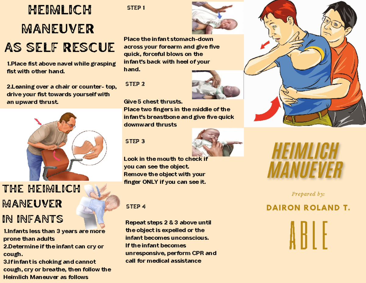 Able- Heimlich Manuever - A B L E D A I R O N R O L A N D T. Prepared by: HEIMLICH MANEUvER AS ...