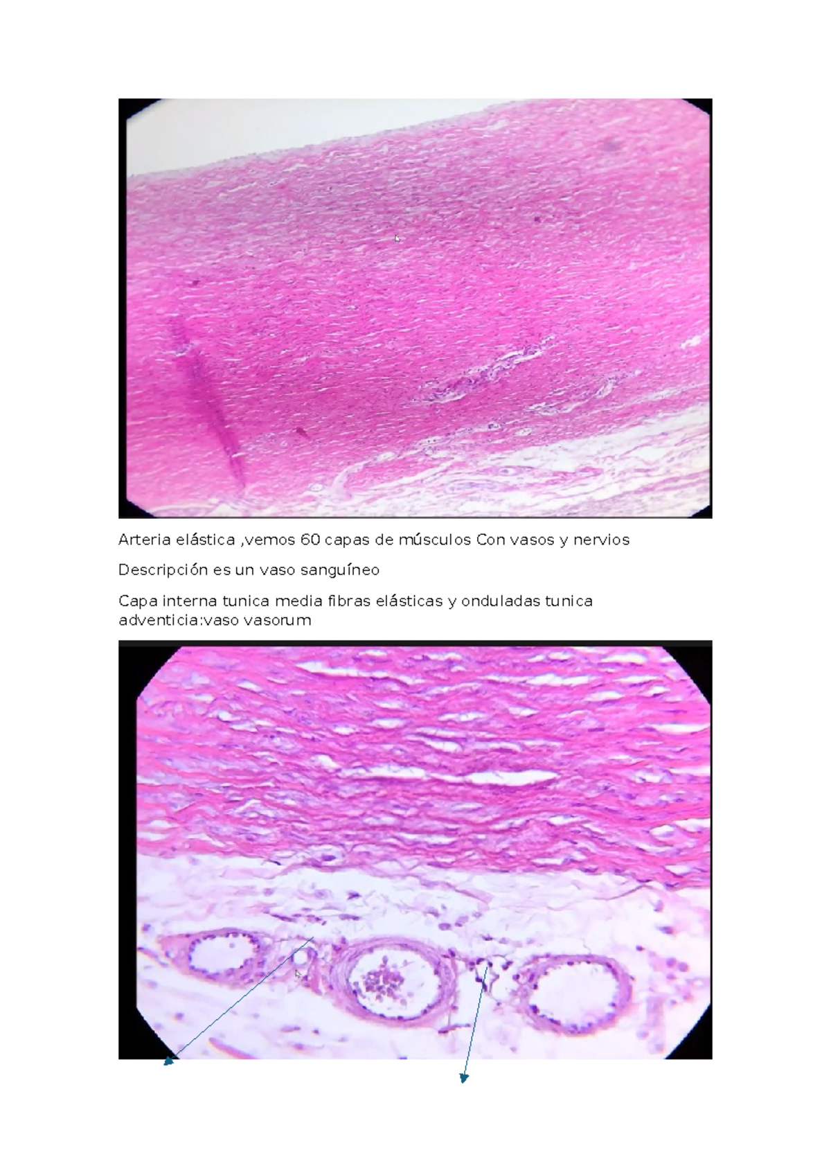 Arteria elástica - Arteria elástica ,vemos 60 capas de músculos Con ...
