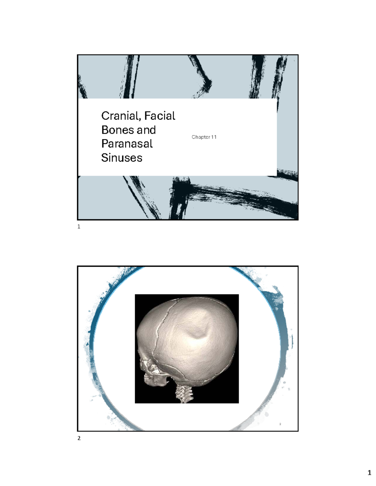 Anatomy of Cranial and Facial Bones with Sinuses - Studocu