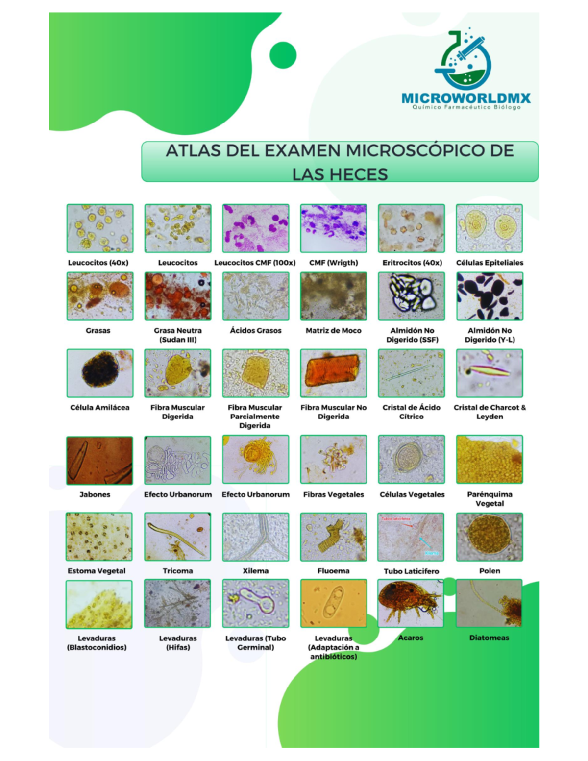7. Interpretación del Examen Microscópico de Heces: Leucocitos y Más ...