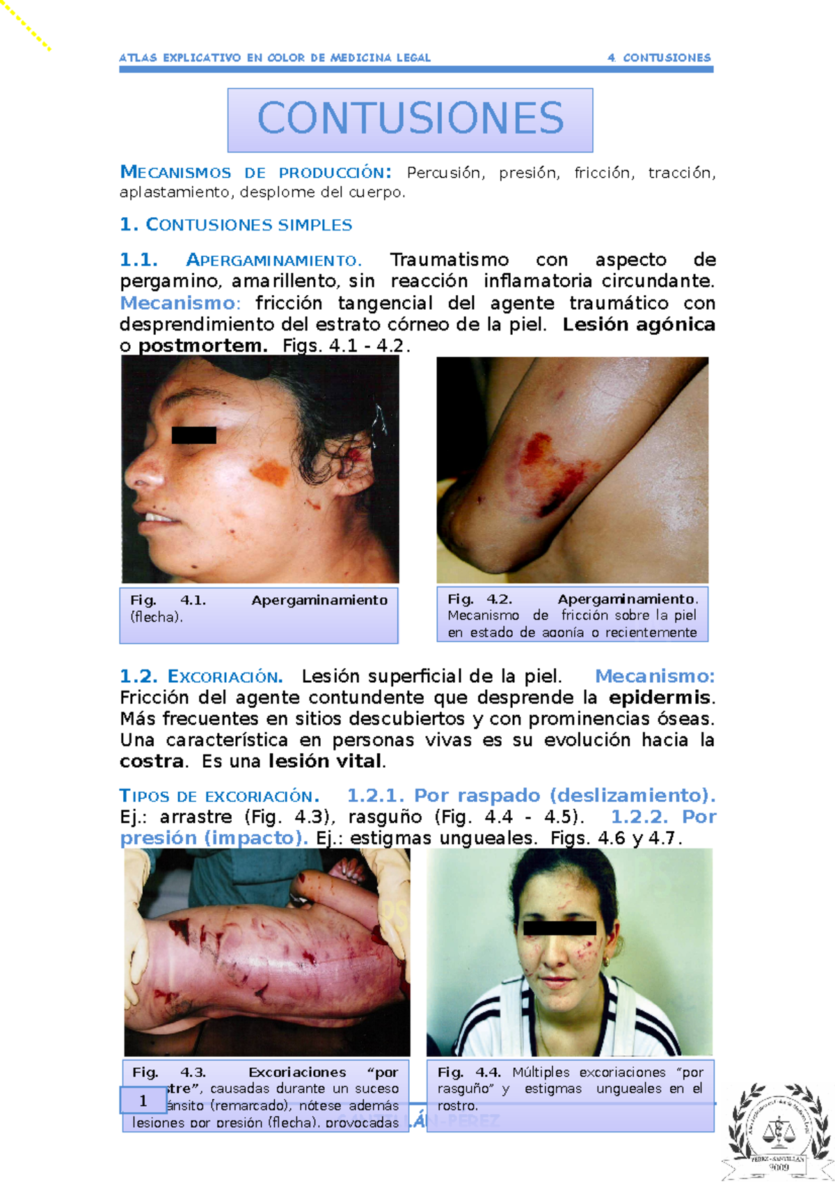 Contusiones - MECANISMOS DE PRODUCCIÓN: Percusión, presión, fricción ...