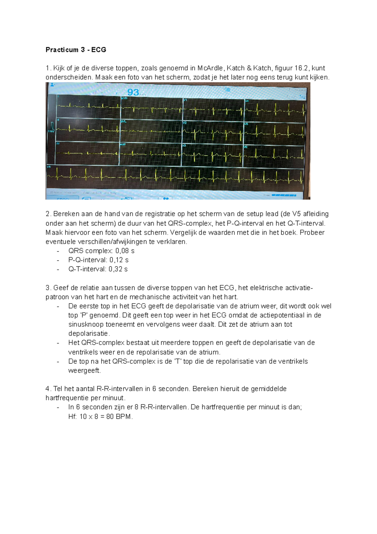 ECG Practicum 3: Analyse van Hartfrequentie en Activatiepatronen ...