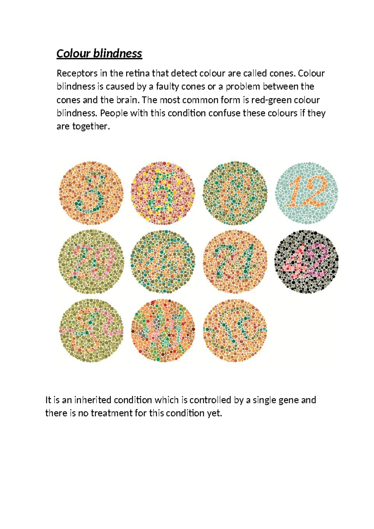 B3 - Biology GCSE Revision: The Eye and Vision Disorders - Studocu