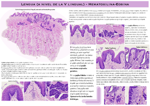 Neumoctos tipo I y tipo II - Neumocitos I y Neumocitos II ¿Qué son? Son ...